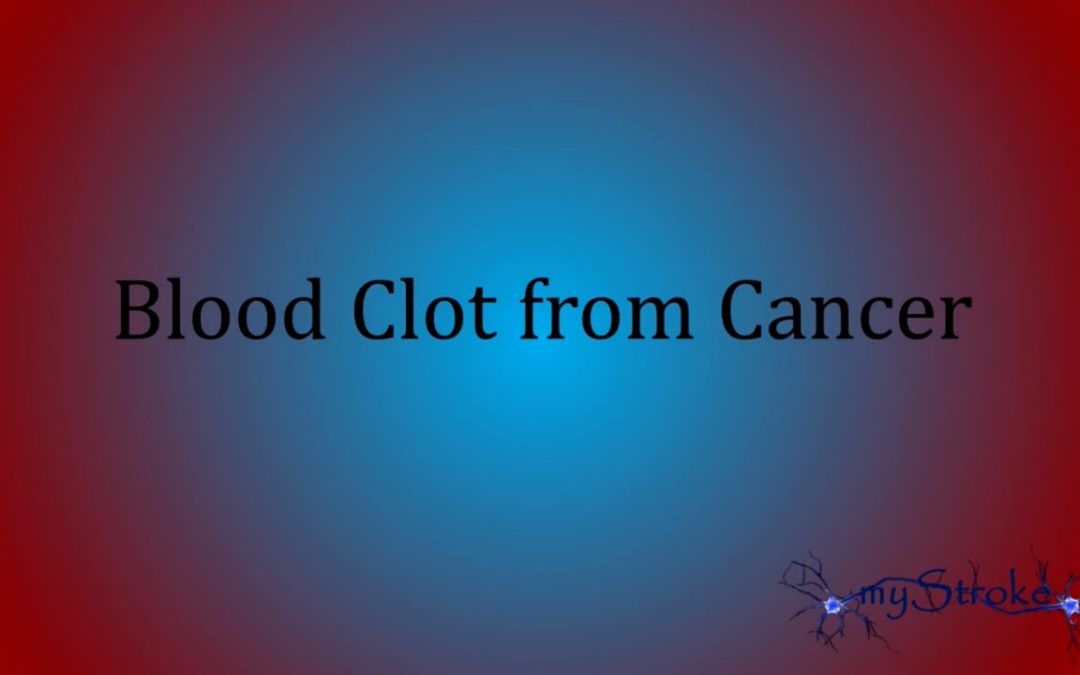 Blood Clot from Cancer - My Stroke
