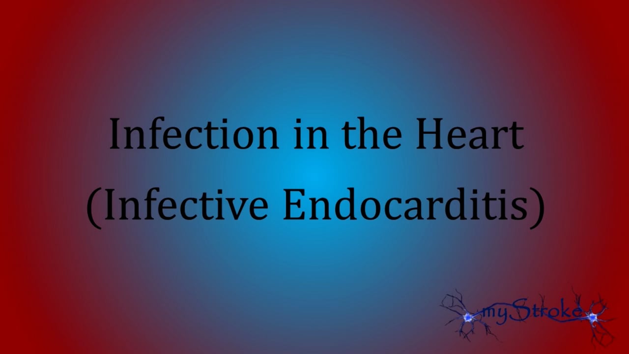 Infective Endocarditis - My Stroke